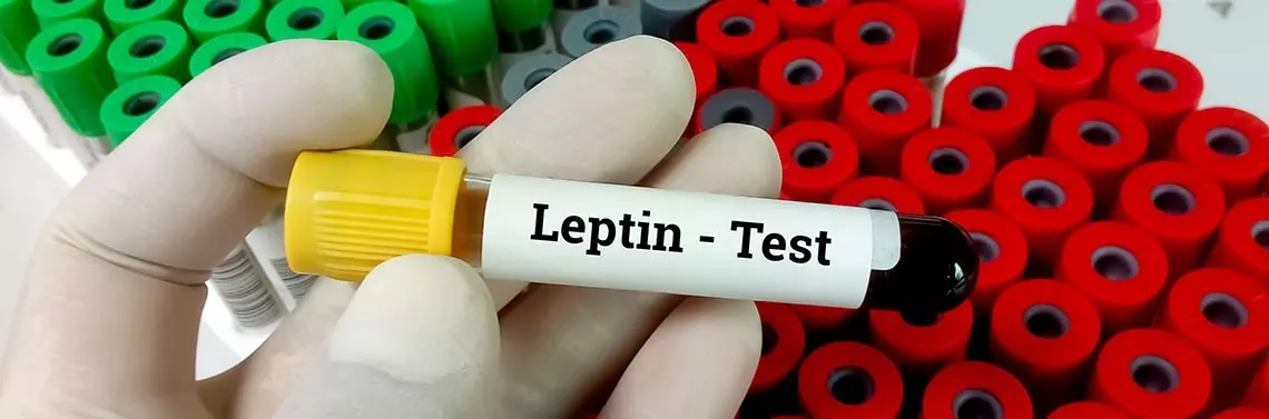 Leptynooporność – diagnostyka i leczenie - Food Forum – czasopismo ...